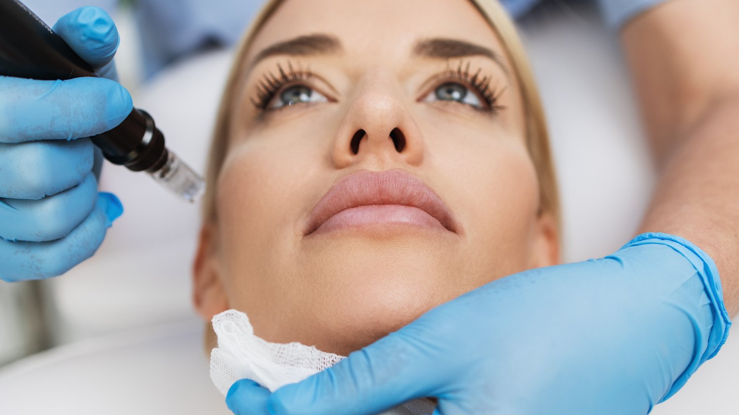 Microneedling Treatment | Dr Apul Parikh | London Victoria